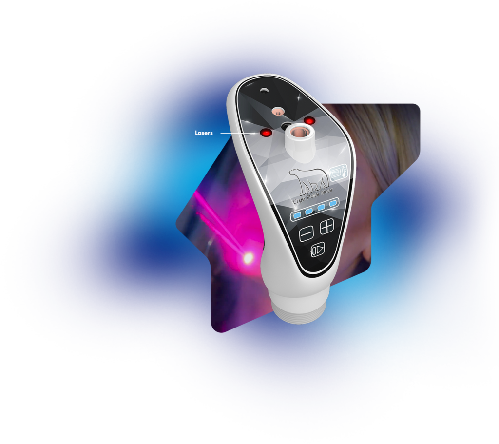 Cryo Local Polar Bear - Localized cryotherapy (cryogenic blower)