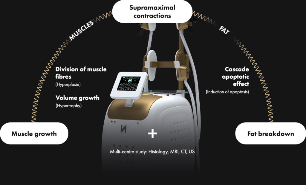 VA Body Sculpt - Electromagnetic technology – HIFEM